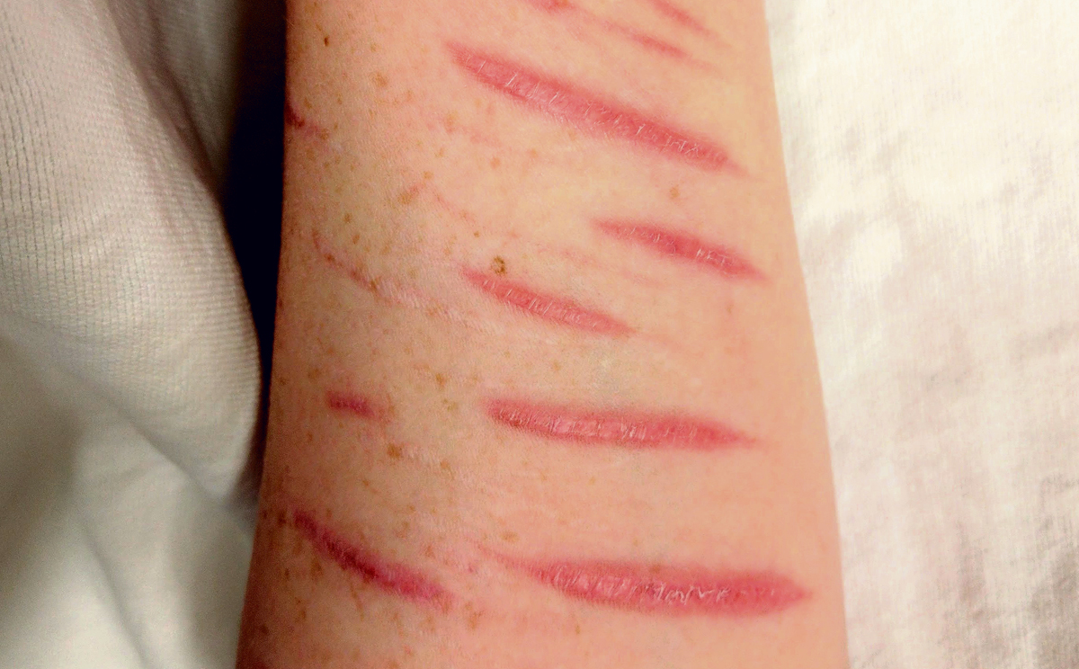 Self harm Patients Need Better Care Morning Star Self harm Patients Need Better Care Morning Star
